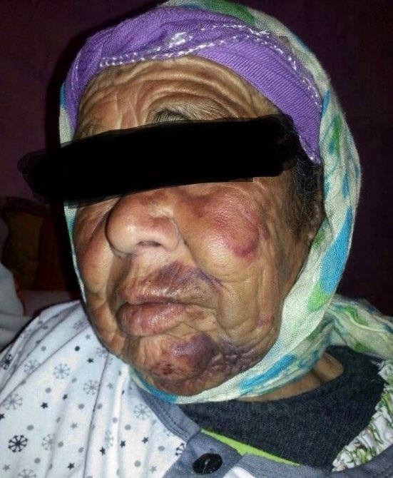 حصري كش 24 تكشف عن تطورات جديدة في قضية الإعتداء على عجوزين نواحي